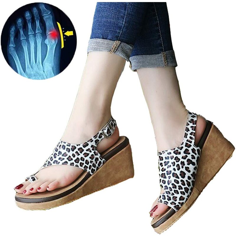 Wing Sandali da donna con zeppa per alluce valgo - Stileo.it